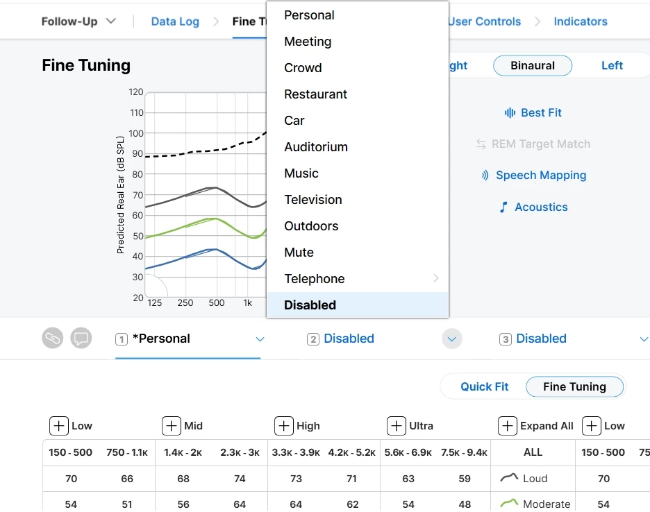 Starkey Edge AI Detailed Expert Review & Pricing [2025]